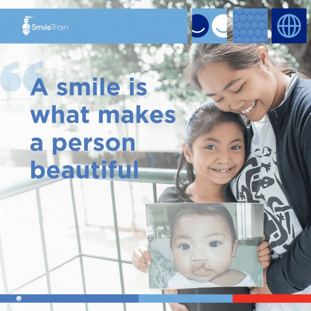 Smile Train: Creating Wonderful Smiles Over The Years | Greenbulb ...